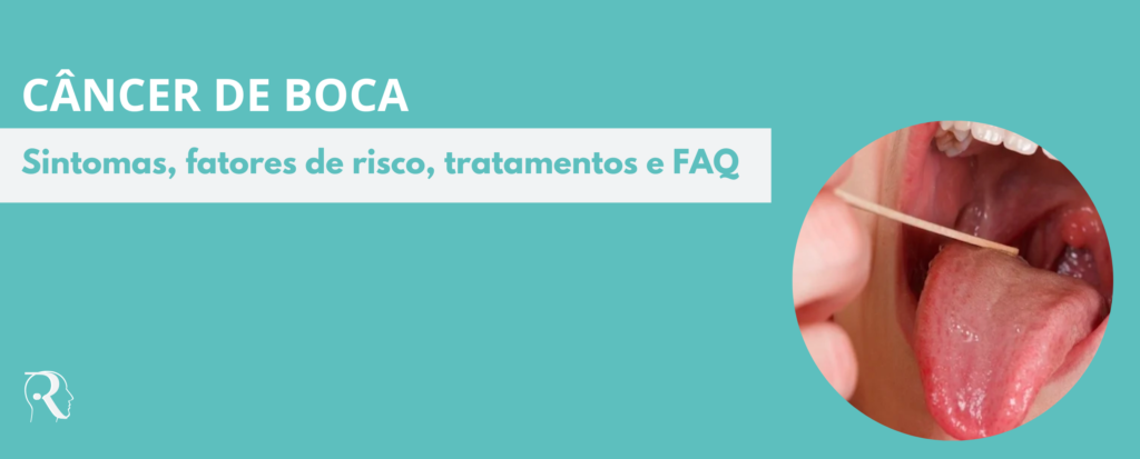 Câncer de Boca: Sintomas, Fatores de Risco, Tratamentos e Perguntas ...